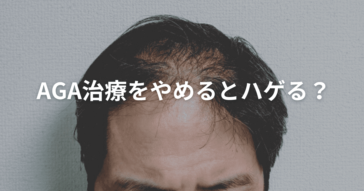 AGA治療をやめるとハゲる？中止した場合に考えられる頭皮への影響 | AGAスマクリマガジン
